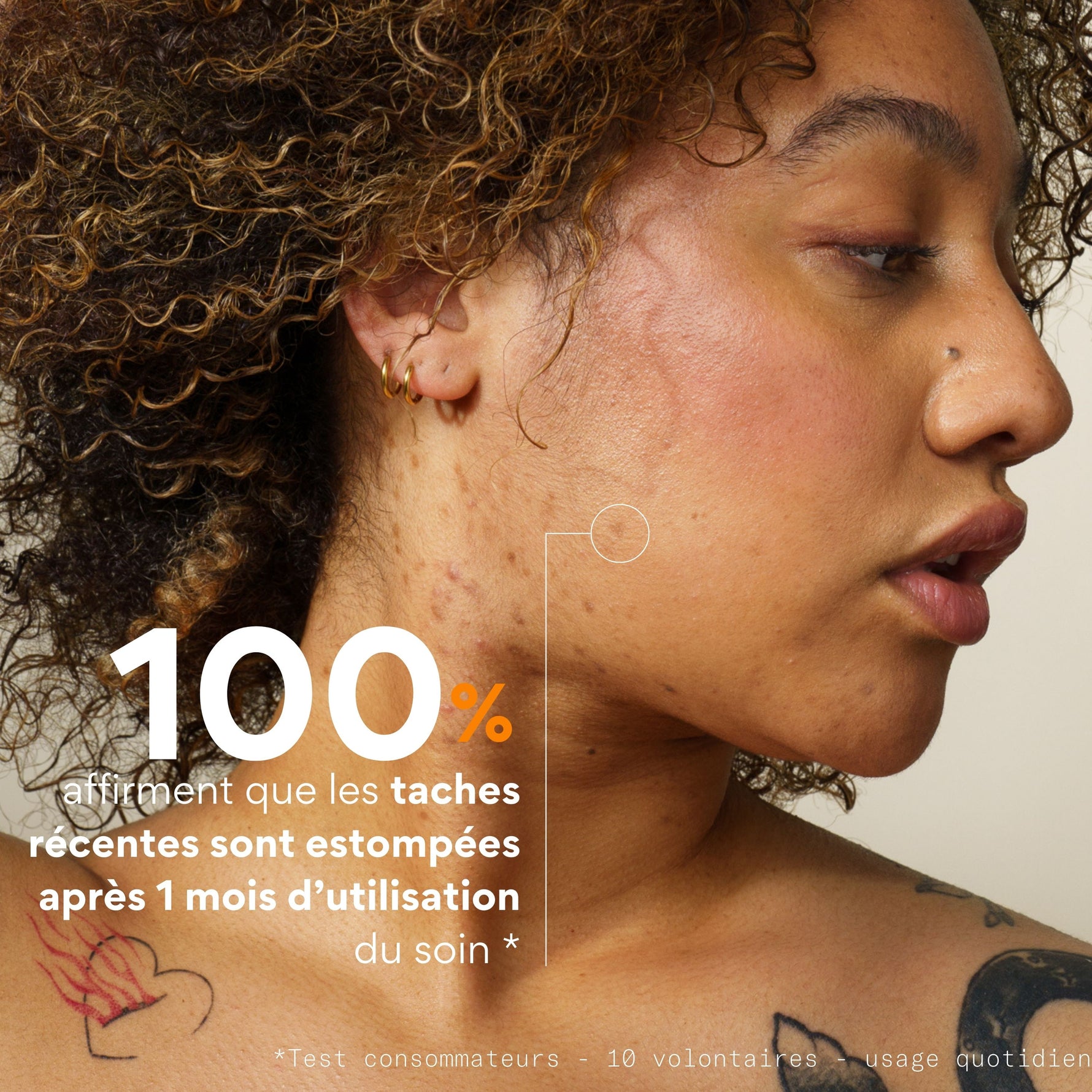 Soin Anti-Tache Acné - 100/100 sur Yuka – Skin & Out
